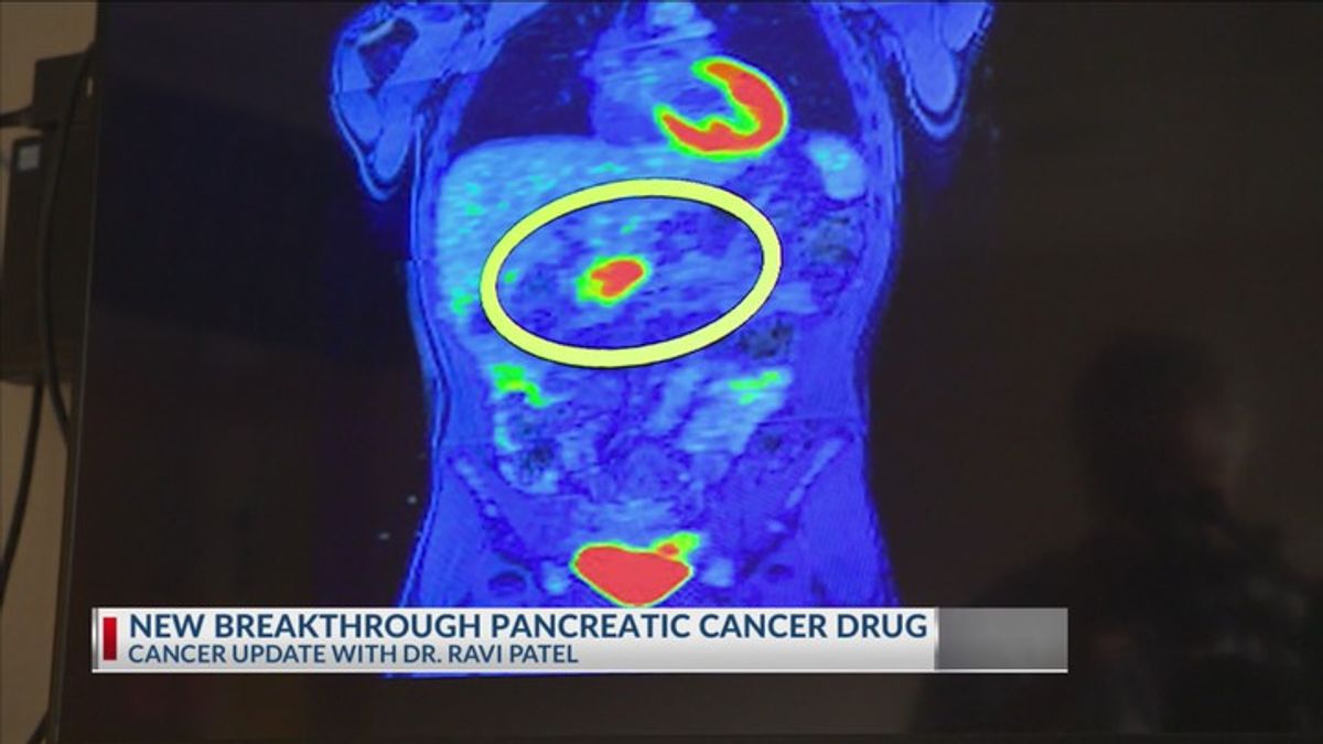 'New hope for cancer patients': Dr. Patel on the major breakthrough in ...