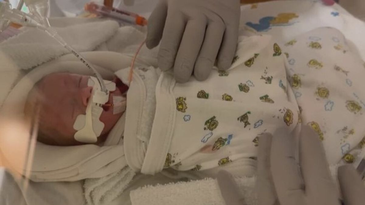 Holden’s Miracle Story: Baby born 11 weeks early survives with help ...