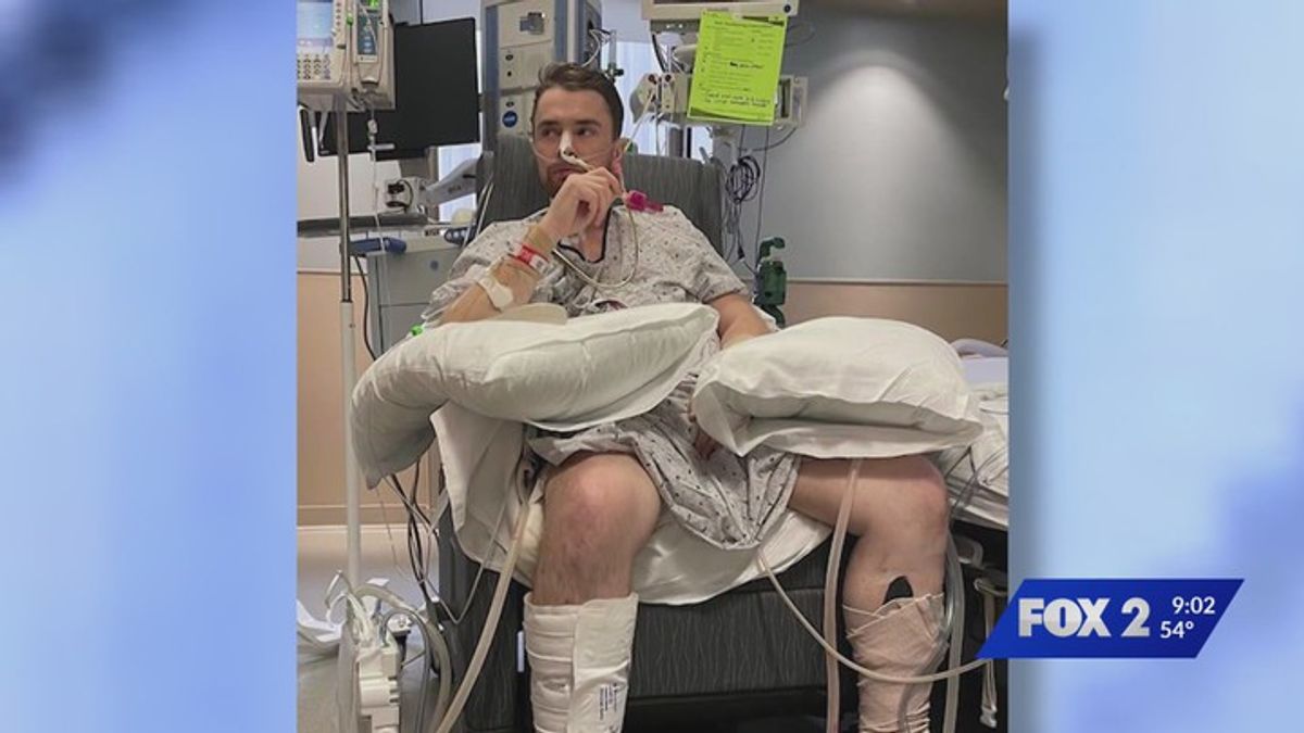 Former injured STL officer undergoes partial leg amputation, hopes to ...