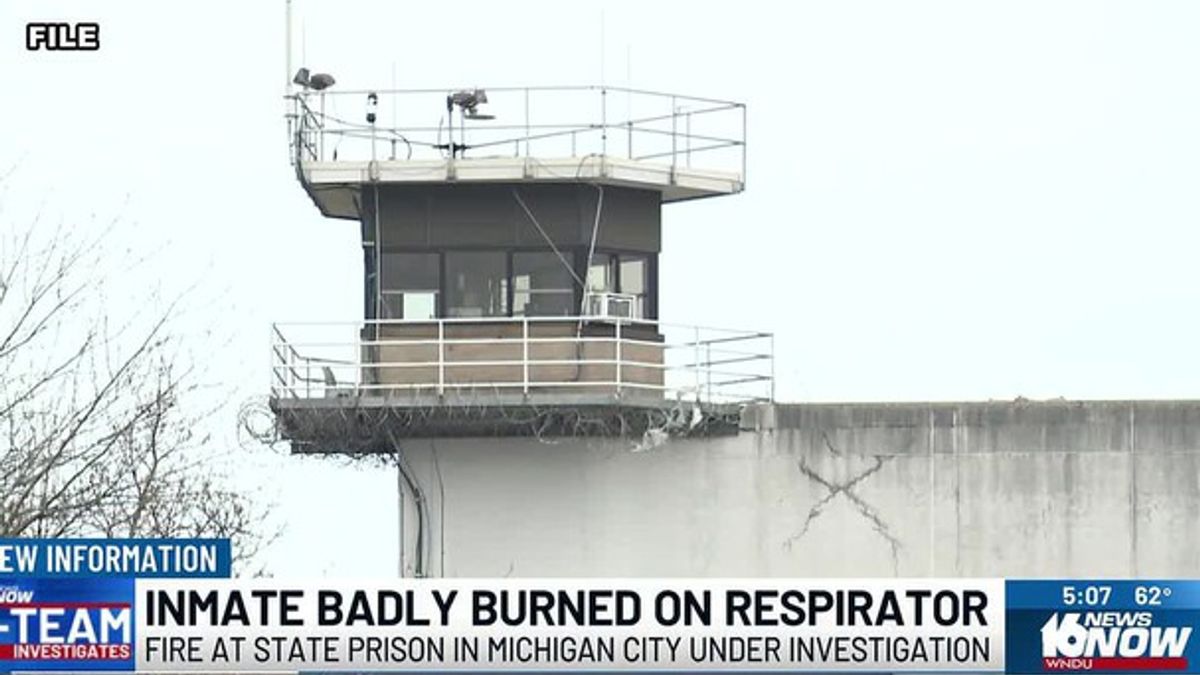 Indiana State Prison inmate on respirator after suffering severe burns ...