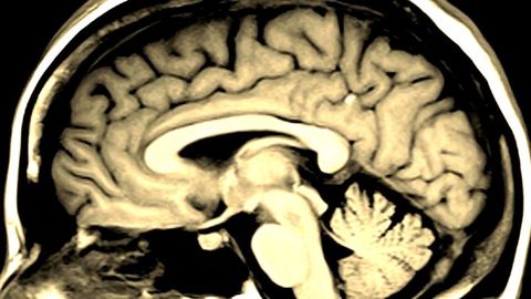 Scientists Map the Previously Only Theorized Human Brain ‘Sewage System ...