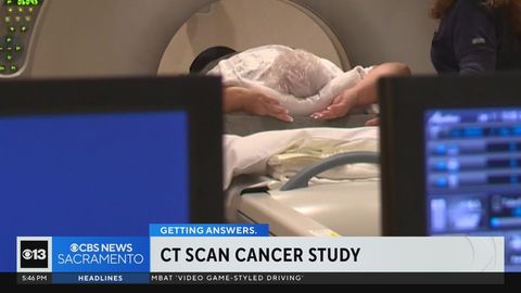 New research shows CT scans may account for 5% of all cancer cases ...