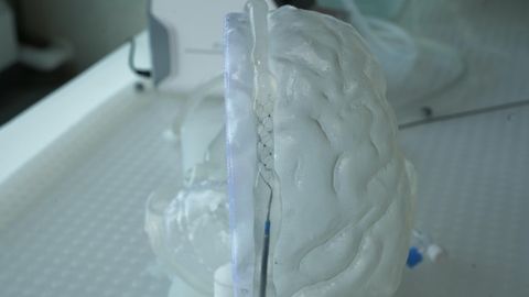 Brain Computer Interface No Open Brain Surgery Required Haystack News