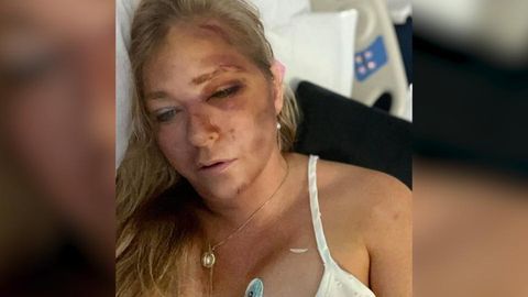 Virginia Giuffre says she is in critical condition after car accident ...
