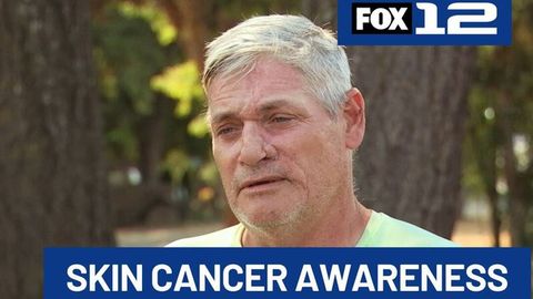 Untreated skin cancer leads to 9-hour facial surgery for Oregon ...