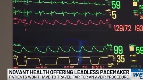 Novant Health offers leadless pacemaker option for patients | Haystack News